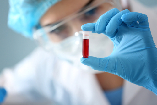 Klinisch Chemisch Laboratorium (voor verwijzers) | Deventer Ziekenhuis